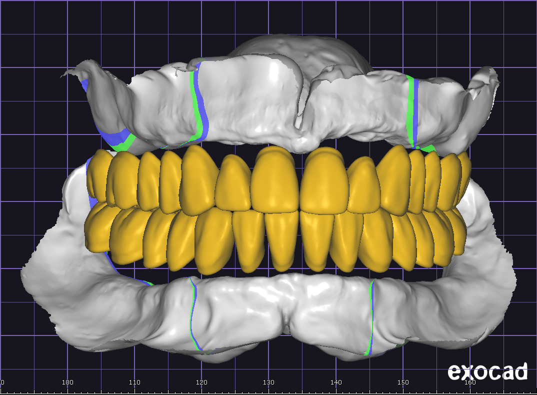 Pivotal Denture Studio – Your Partner In Digital Denture Designs